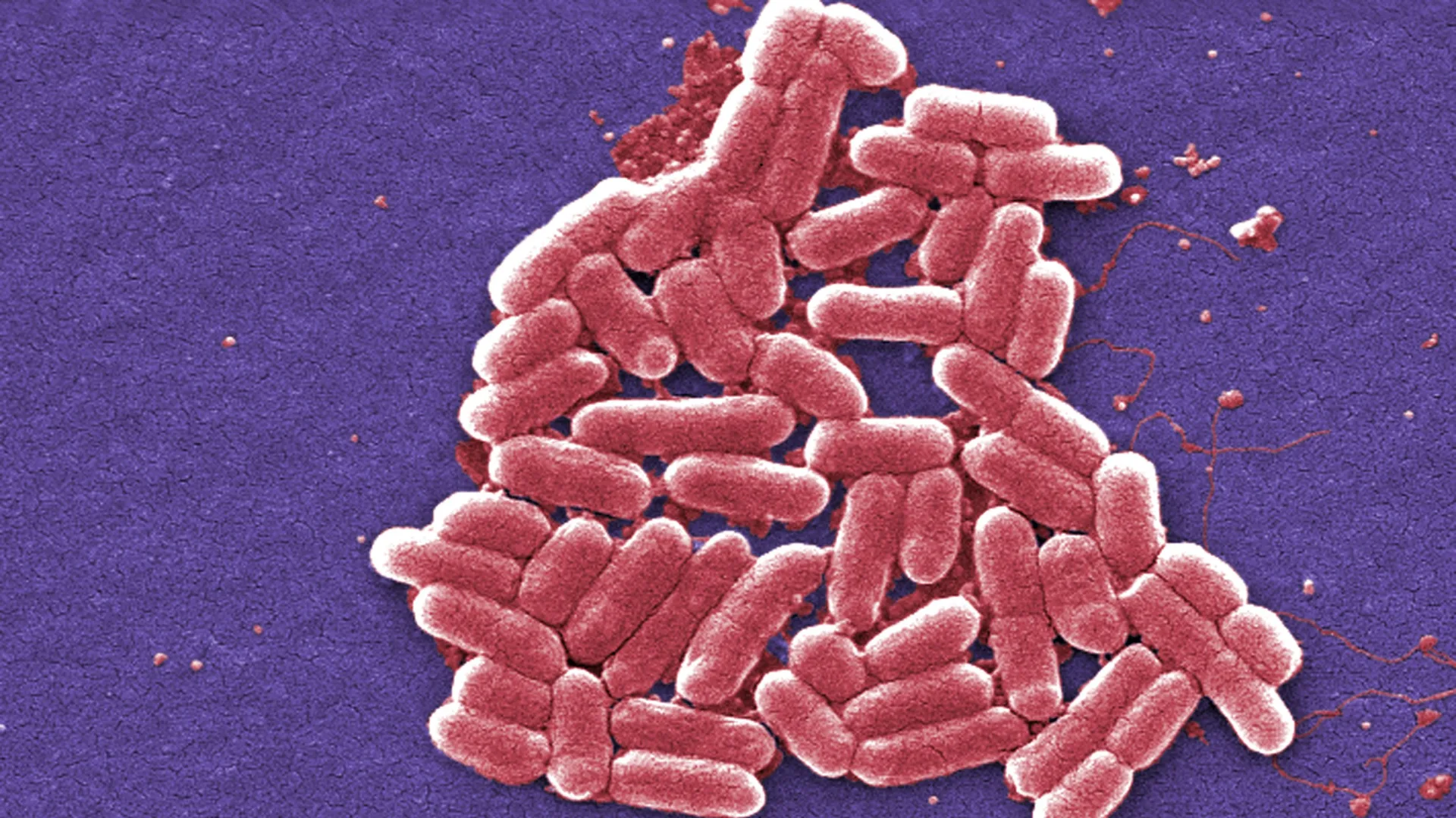 Brote E. Coli The Kebab Shop 2026 | Abogados